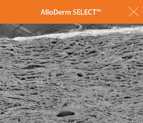 AlloDerm™ RTM Product Performance