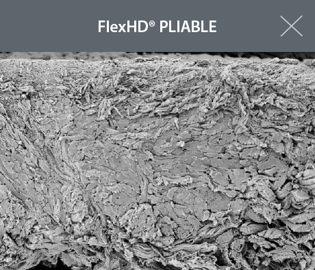 AlloDerm™ RTM Product Performance