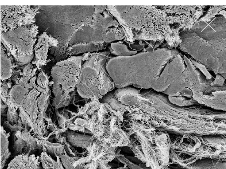 AlloDerm™ RTM Product Performance