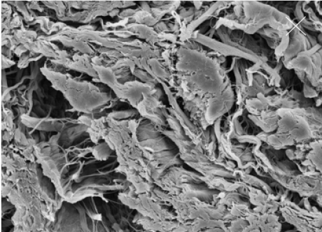 AlloDerm™ RTM Product Performance