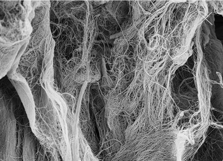 AlloDerm™ RTM Product Performance