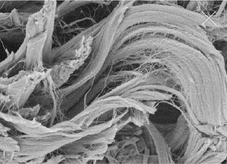 AlloDerm™ RTM Product Performance