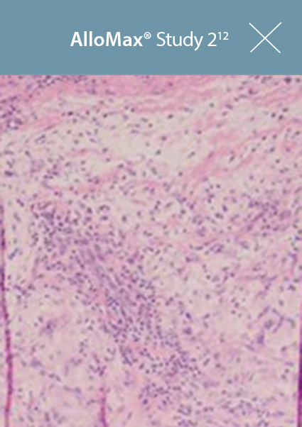 AlloDerm™ RTM Product Performance