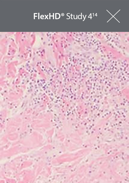 AlloDerm™ RTM Product Performance