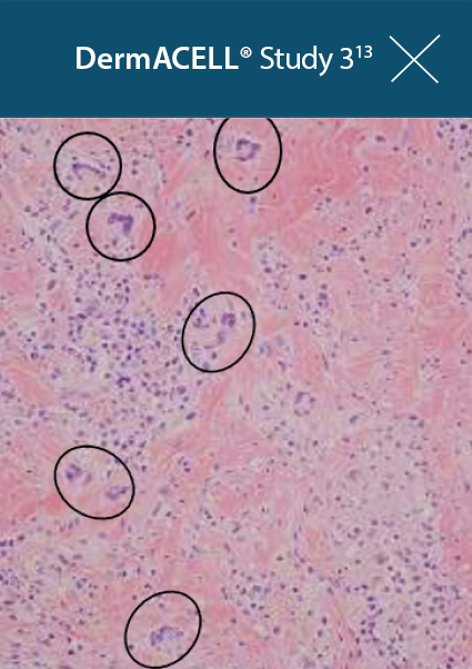AlloDerm™ RTM Product Performance