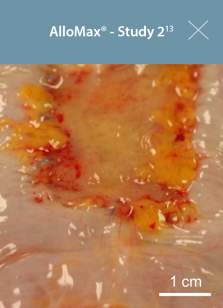 AlloDerm™ RTM Product Performance
